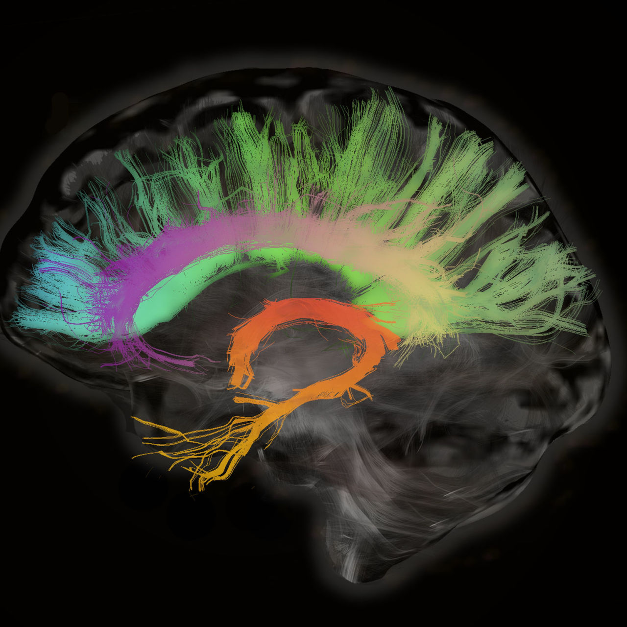 Musicians Brain Graphic