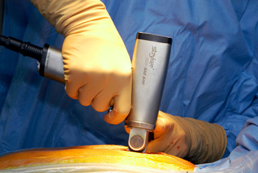 open heart surgery at emaze Presentation